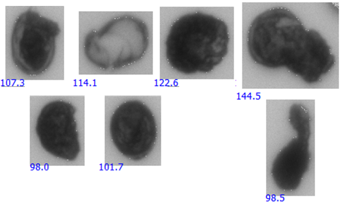 PARTICLE SHAPE APPLICATION EXAMPLE: Pollen - Particle Shape Particle Size