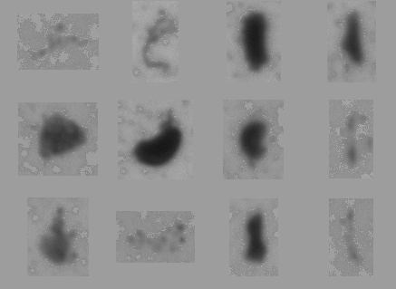 PARTICLE SHAPE APPLICATION EXAMPLE: Ocean Sediments - Particle Shape Particle Size