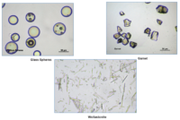Particle shape impact particle size results using different techniques